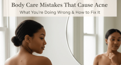 Body Care Mistakes That Cause Acne
