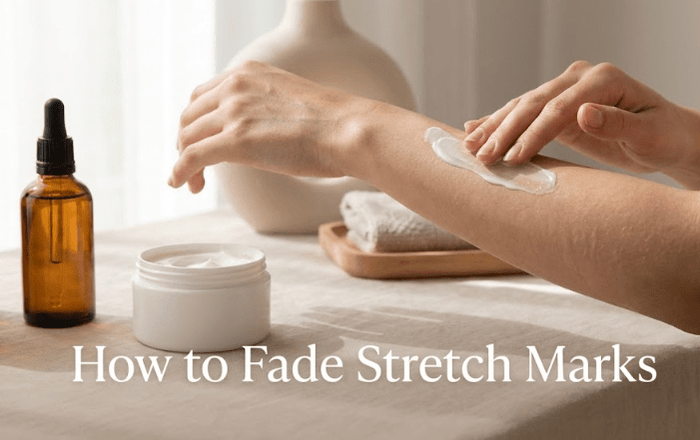 How to Fade Stretch Marks